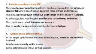 DISEASE OF CRYSTALLINE LENS, CATARACTpptx | PPTX