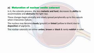 DISEASE OF CRYSTALLINE LENS, CATARACTpptx | PPTX