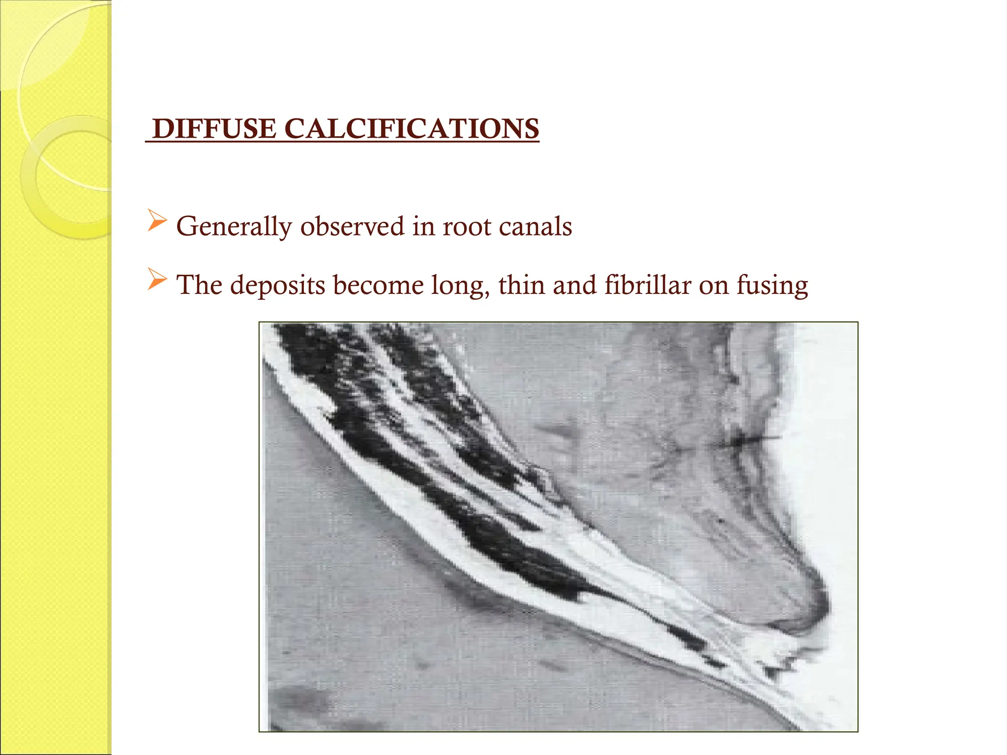 Disease of Dental Pulp powerpoint presentation | PPT