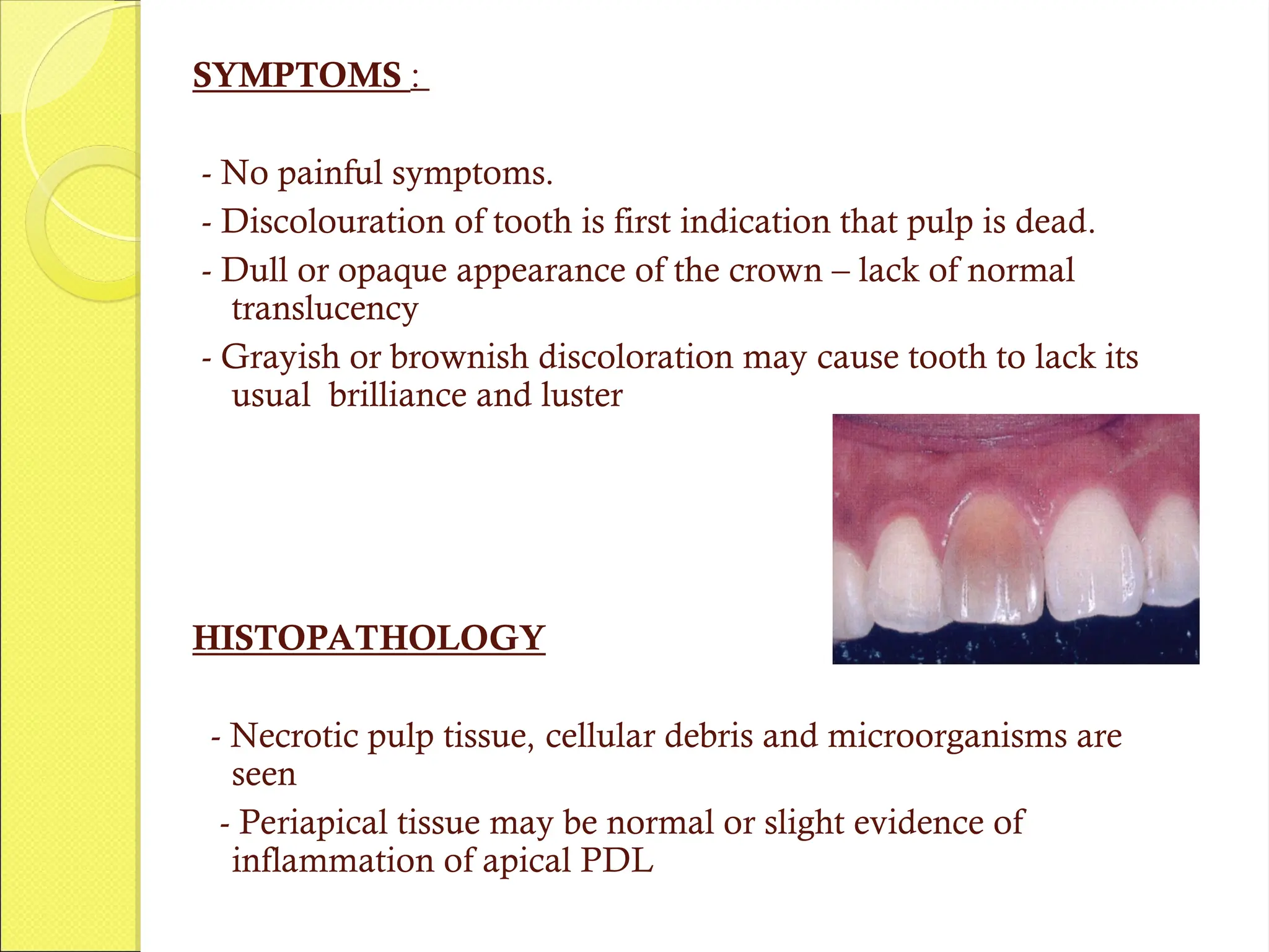 Disease of Dental Pulp powerpoint presentation | PPT