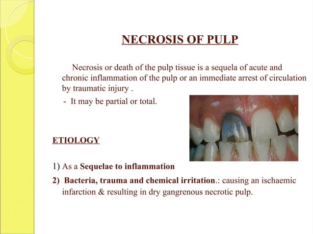 Disease of Dental Pulp powerpoint presentation | PPT