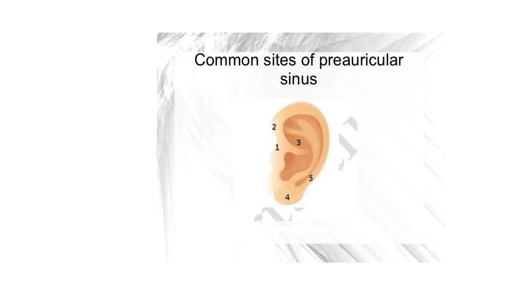 disease of external ear.pptx