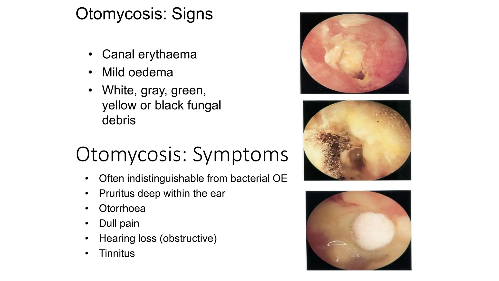 disease of external ear.pptx