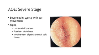 disease of external ear.pptx