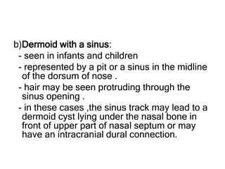 Disease of external nose deviated nasal septum, fb in nose 02.05.16, dr ...