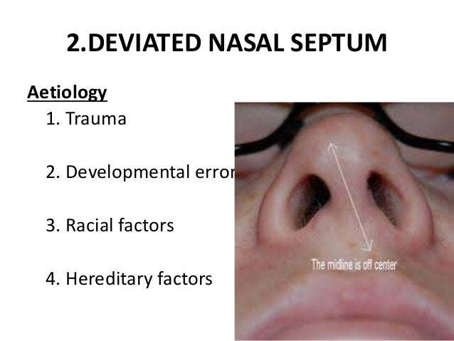 Disease of external nose deviated nasal septum, fb in nose 02.05.16,…
