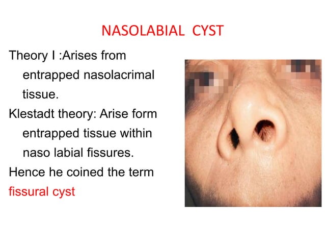 Disease of External Nose & Nasal Cavity | PPTX