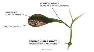 Disease of gall bladder | PPTX