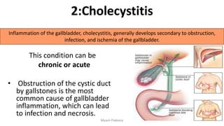 Disease of gall bladder | PPTX