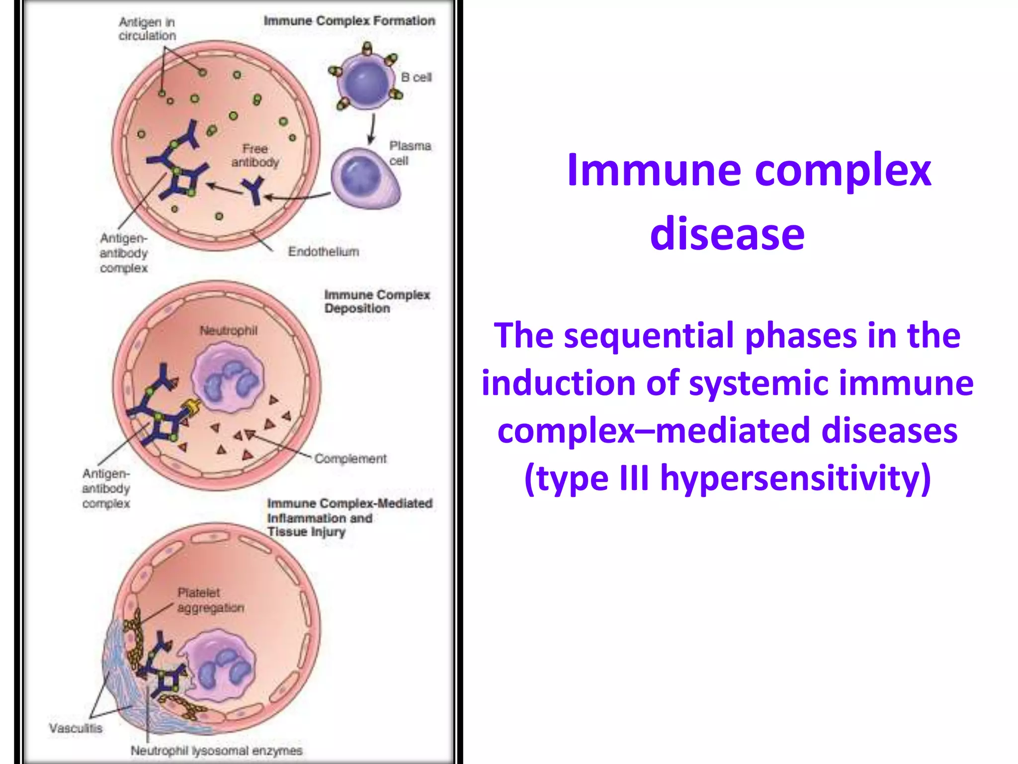 Diseases of the Immune System: Hypersensitivity Reactions | PPTX
