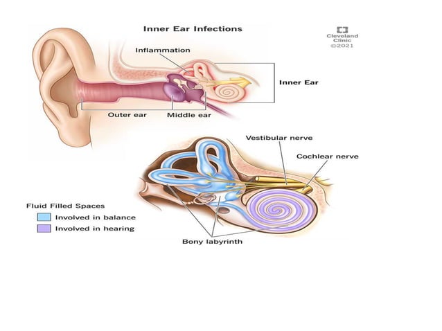 Disease of inner ear.rog.pdf