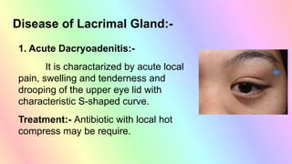 Disease of lacrimal apperatus.ppt by Optom. Saharukh Alam | PDF | Ear ...