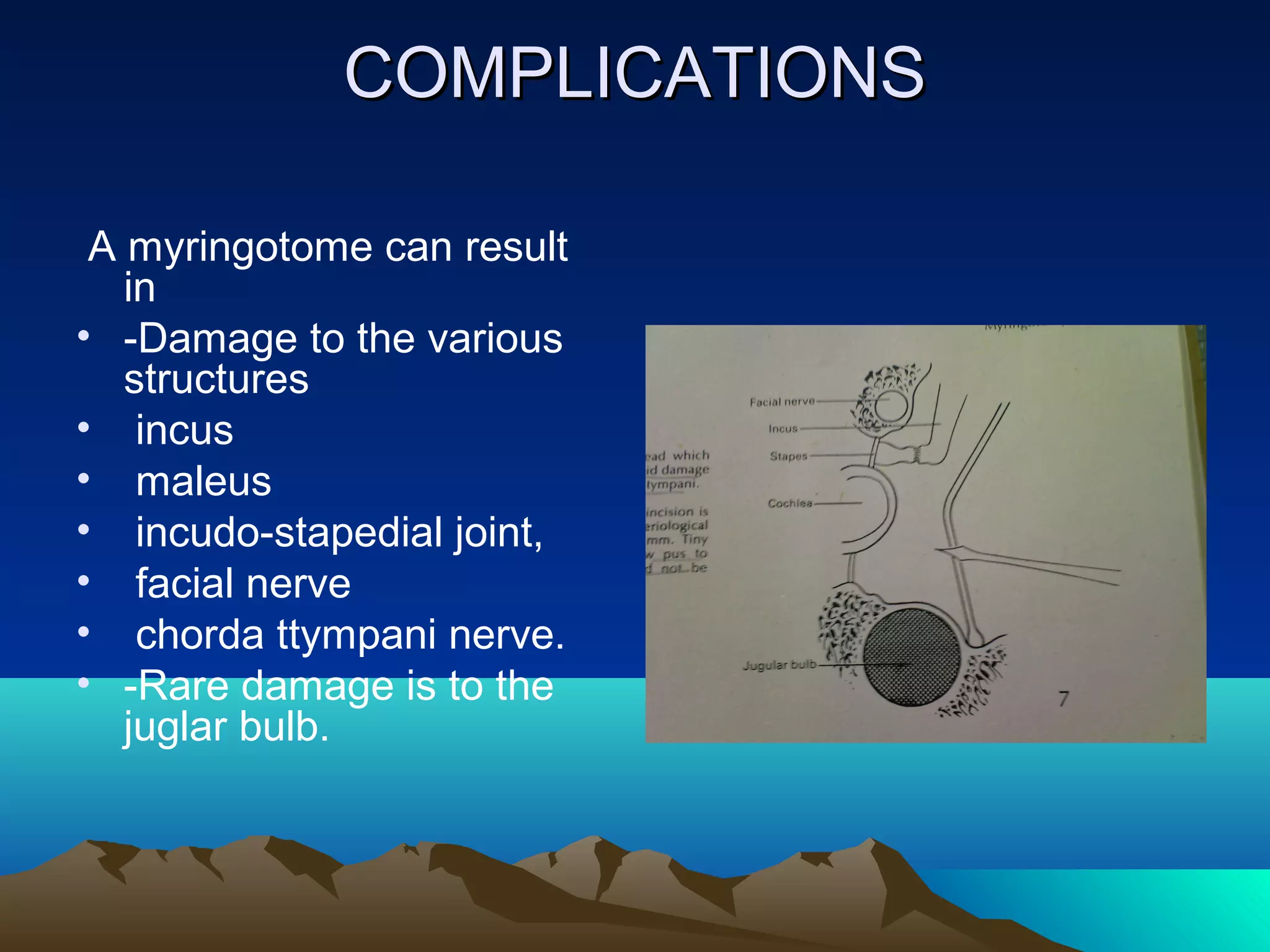 Disease of middle ear | PPT