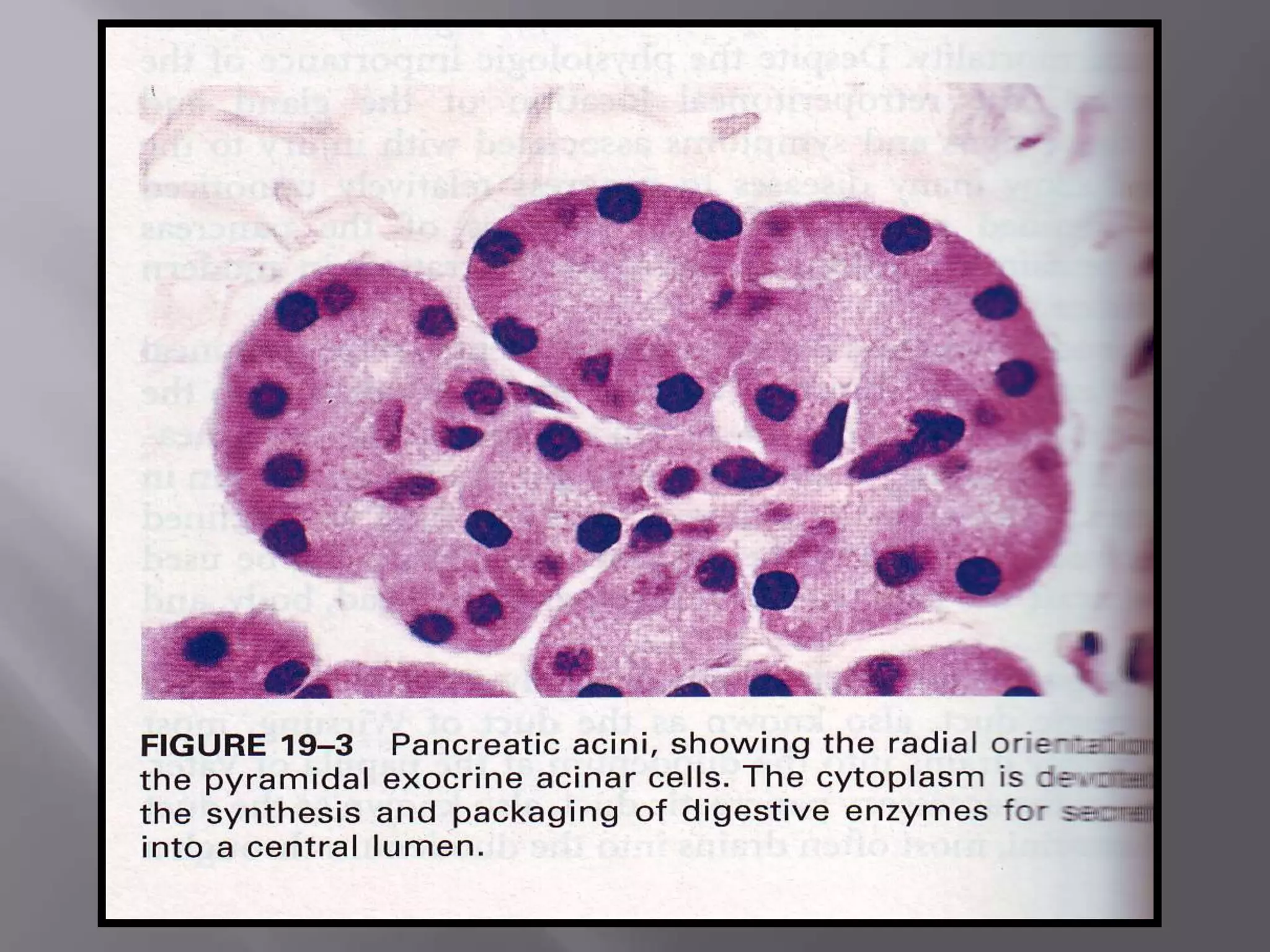 Disease of pancreas | PPT