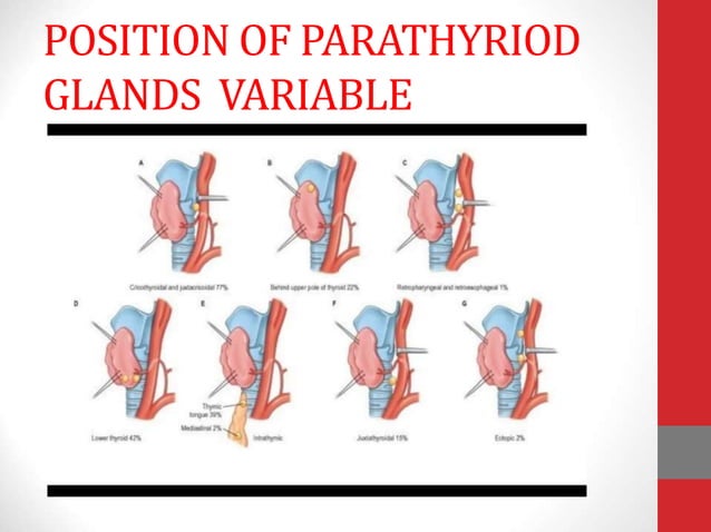 disease of parathyroid & Surgical management/ treatment (BASIC ...