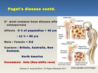Disease of temporal bone.ppt new copy | PPT