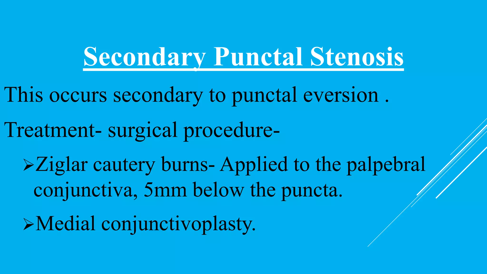 Disease of the lacrimal apparatus | PPTX
