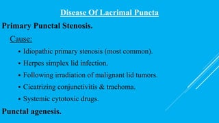 Disease of the lacrimal apparatus | PPTX