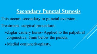Disease of the lacrimal apparatus | PPTX