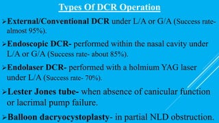 Disease of the lacrimal apparatus | PPTX