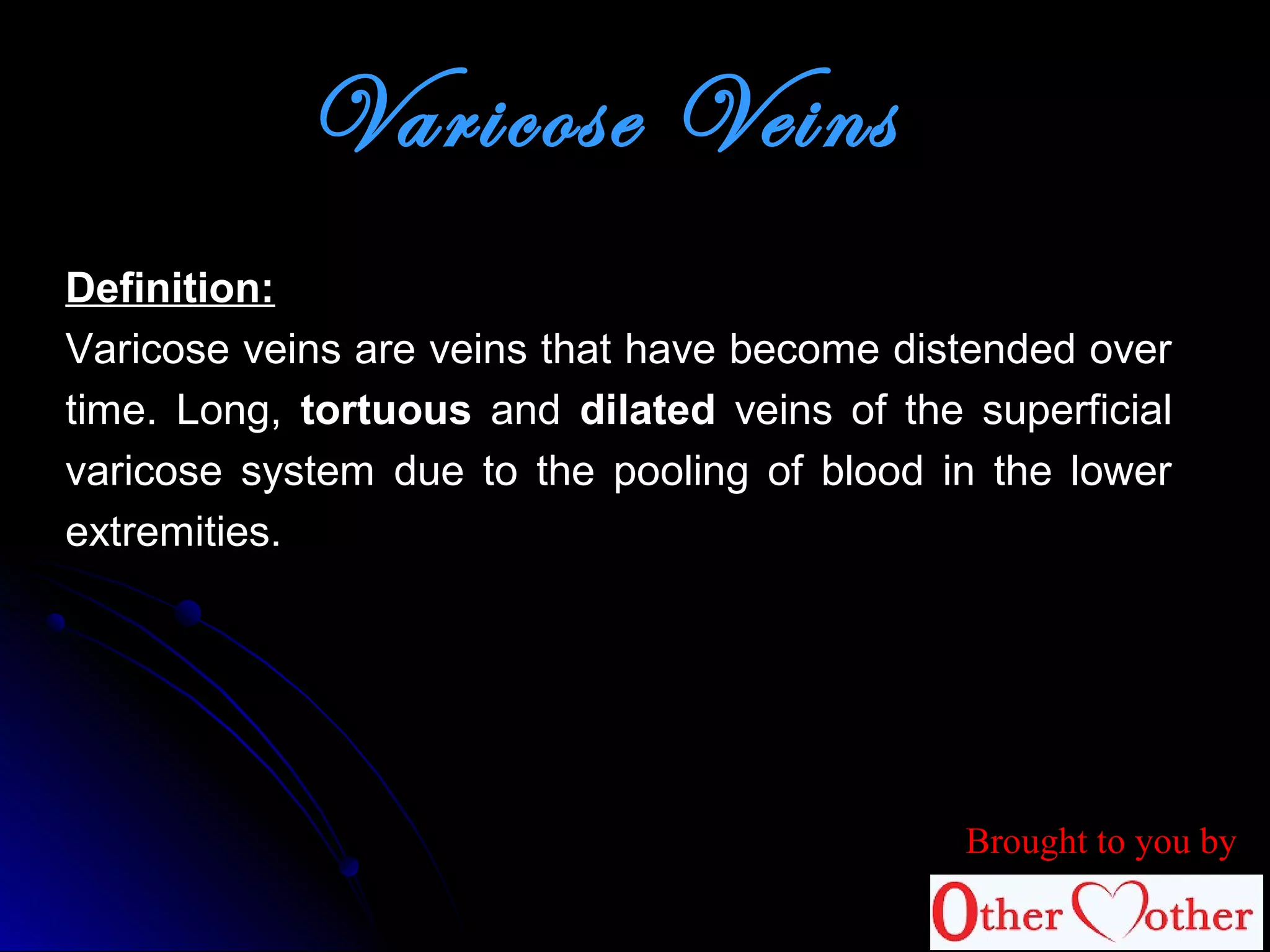 Disease of the veins | PPT