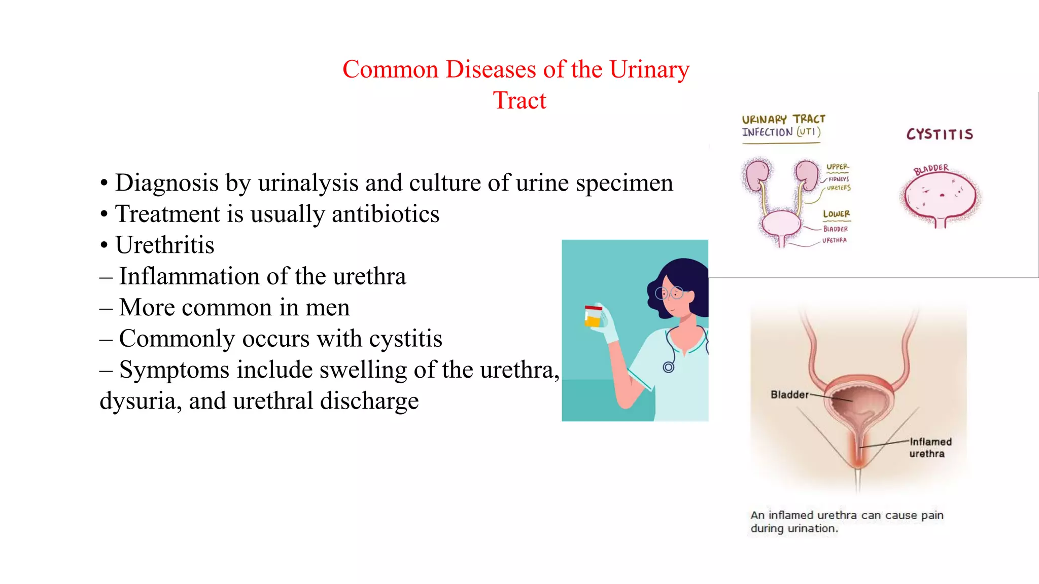 Disease of urinary system | PDF