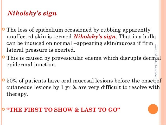 Diseases/certified fixed orthodontic courses by Indian dental academy