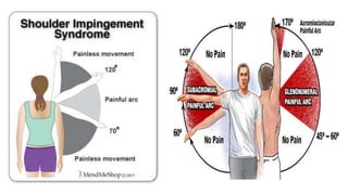 Diseases Low back pain. Painful arc syndrome. Fasciitis. Leprosy. | PPTX