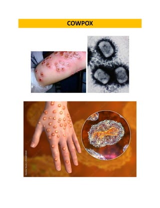 DISEASES INFECTIOUS PICTURES COWPOX .pdf