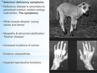 Diseases associated with defeciency of essential trace elements | PPTX