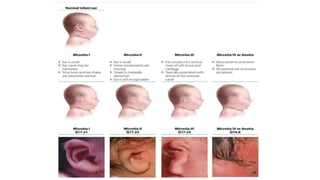 Anatomy-of-external-ear-pinna-canall.pdf