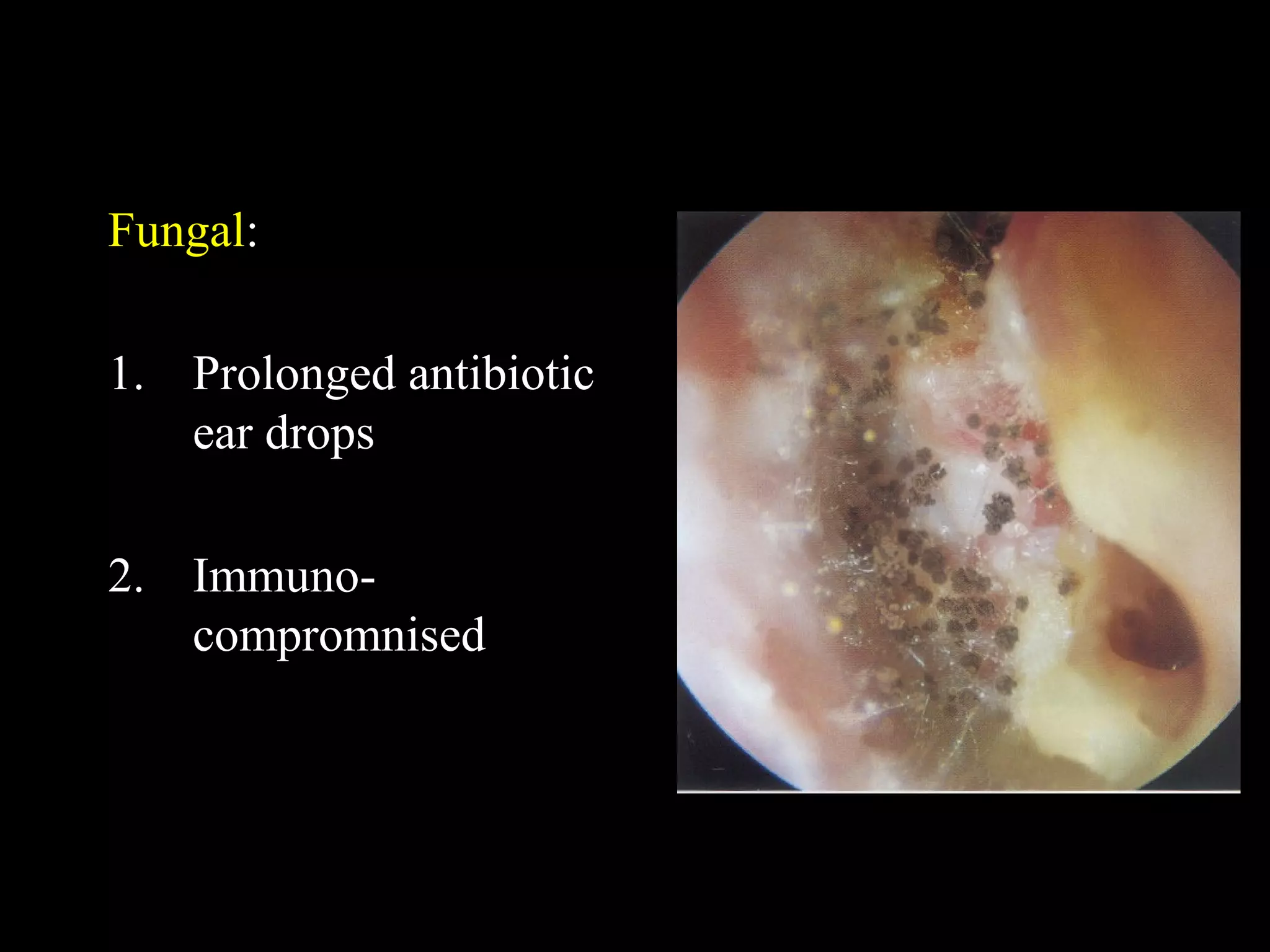 Diseases of external ear ug dr.s.vijaya sundaram 01.02.16