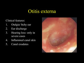 Diseases of external ear ug dr.s.vijaya sundaram 01.02.16