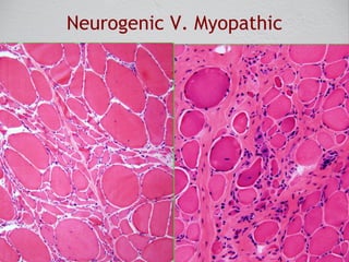 Pathology of Skeletal Muscle | PPT