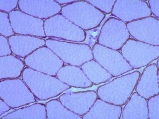 Pathology of Skeletal Muscle | PPT