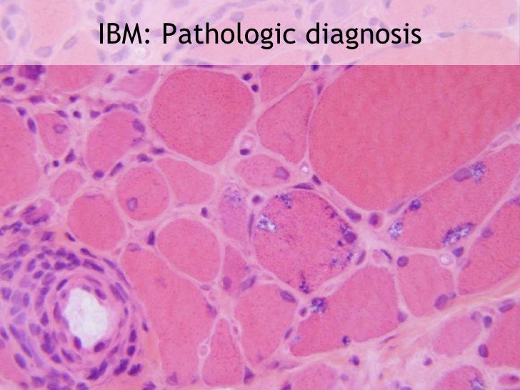 Pathology of Skeletal Muscle