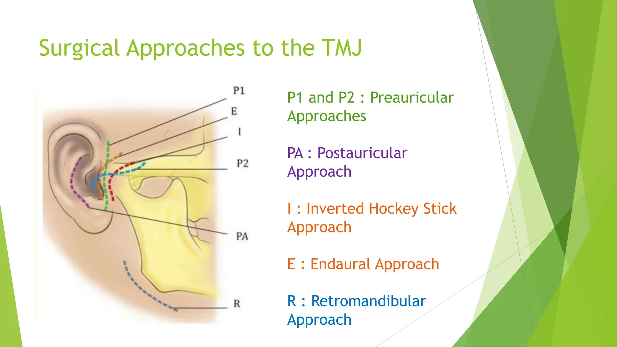 Classification of Diseases of TMJ and TMJ ankylosis in detail | PPTX