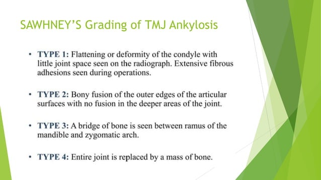 Classification of Diseases of TMJ and TMJ ankylosis in detail | PPTX