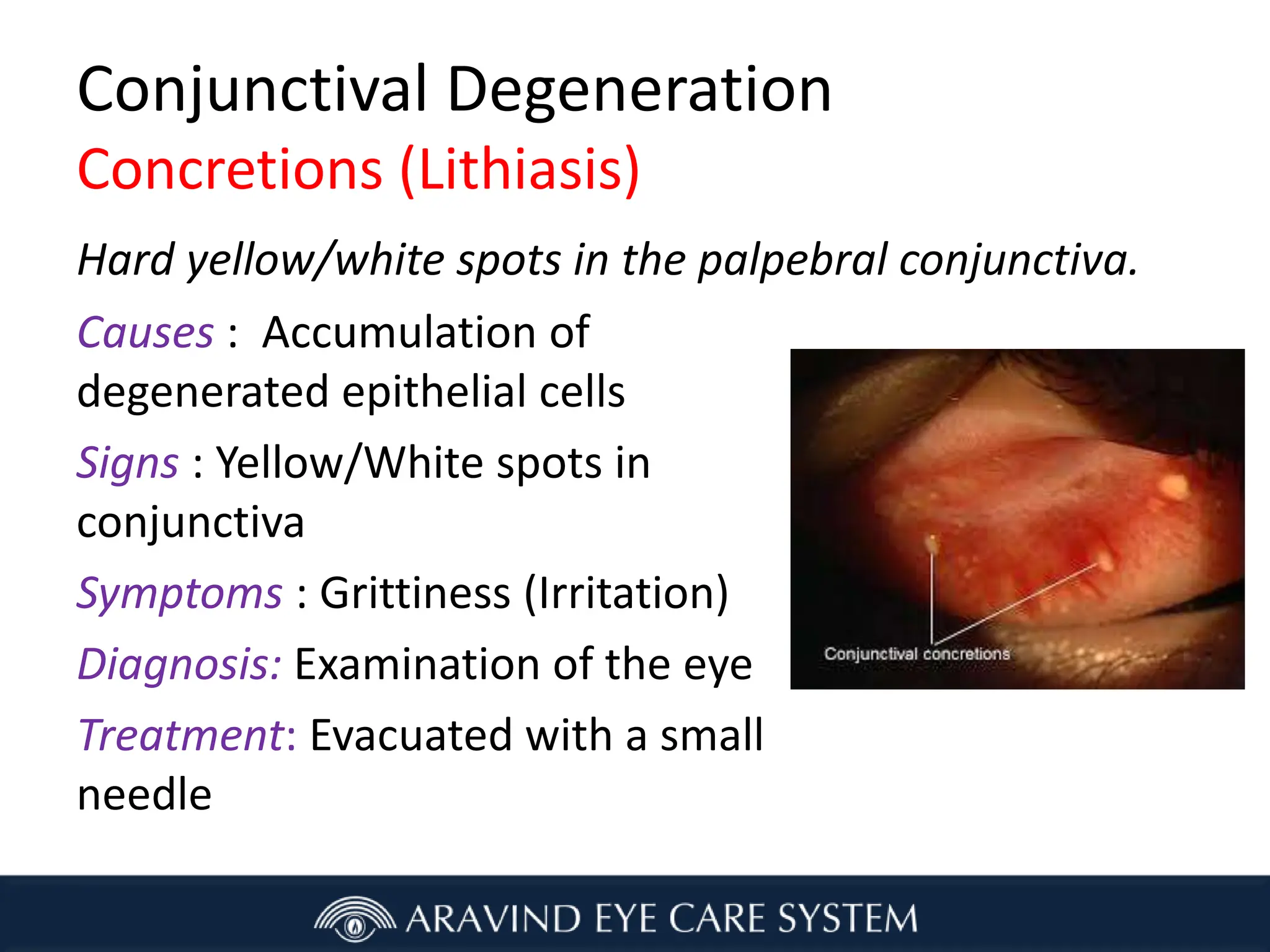 Diseases and Disorders of Conjunctiva.pptx