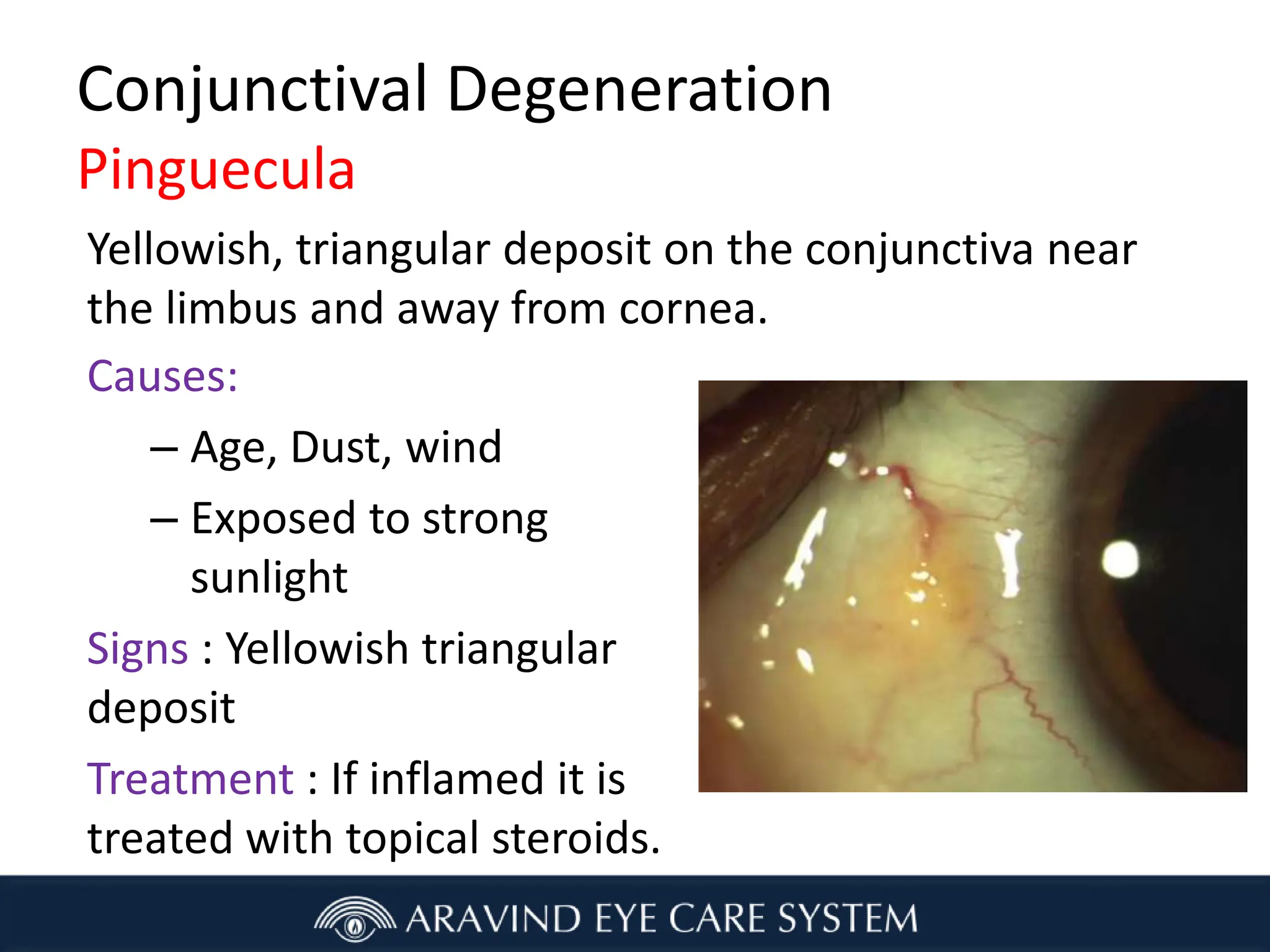 Diseases and Disorders of Conjunctiva.pptx