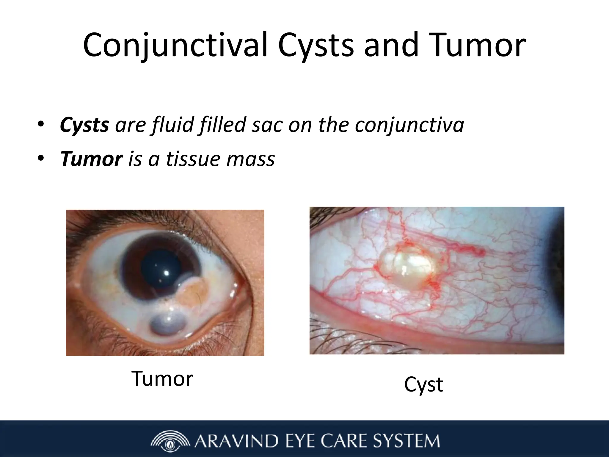 Diseases and Disorders of Conjunctiva.pptx