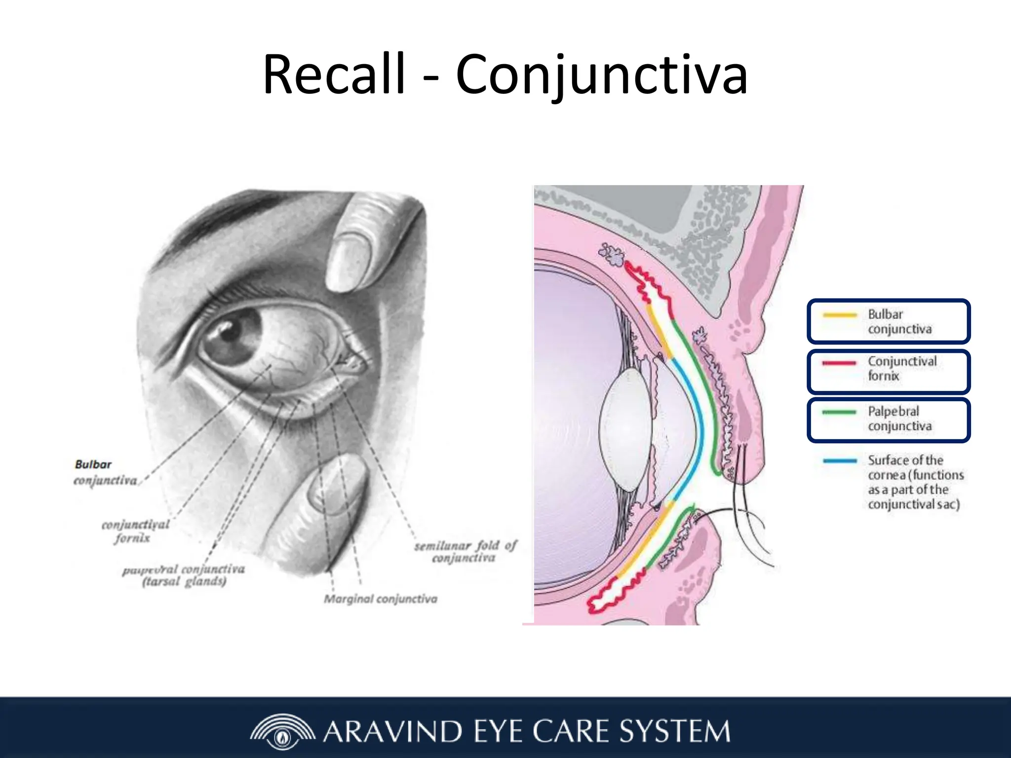 Diseases and Disorders of Conjunctiva.pptx