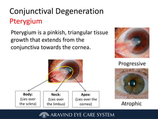 Diseases and Disorders of Conjunctiva.pptx
