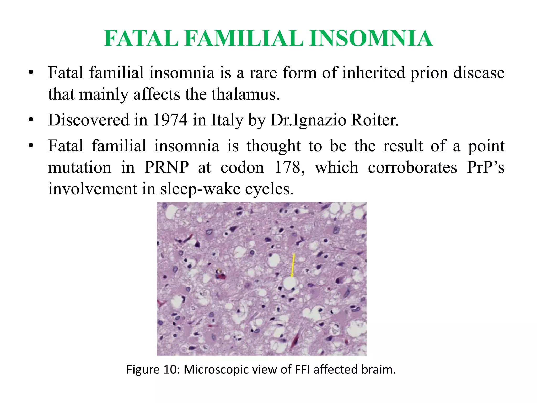 Diseases caused by prions | PPTX