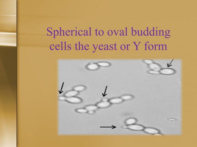 Diseases caused by yeast.pdf | Skin and Dermatology | Diseases and ...