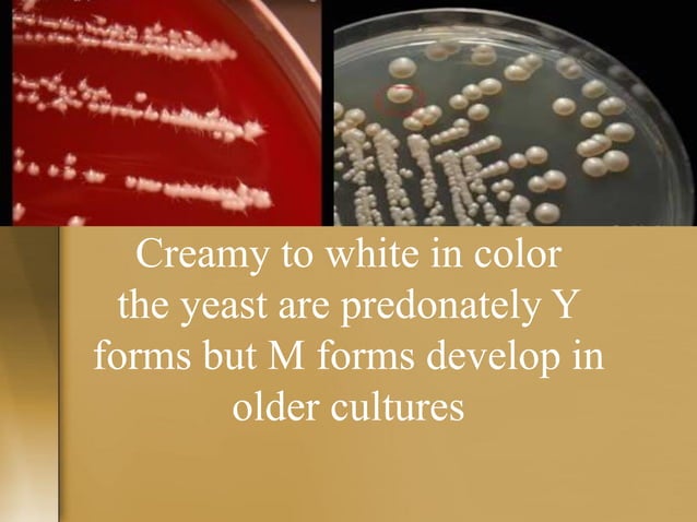 Diseases caused by yeast.pdf | Skin and Dermatology | Diseases and ...