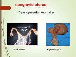 Diseases & disorders of female reproductive system | PPT