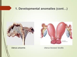 Diseases & disorders of female reproductive system | PPT