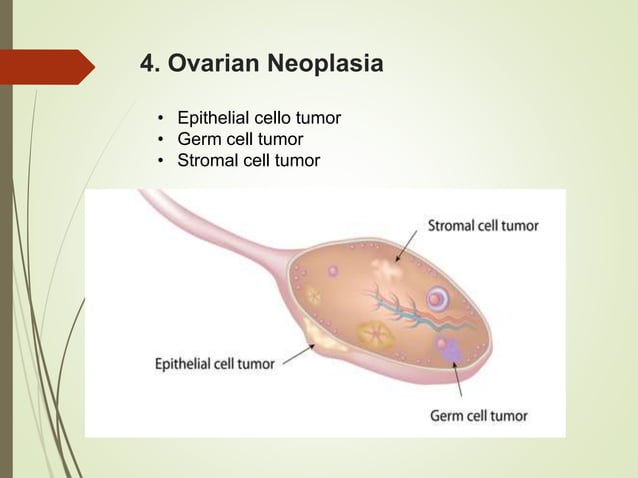 Diseases And Disorders Of Female Reproductive System Ppt