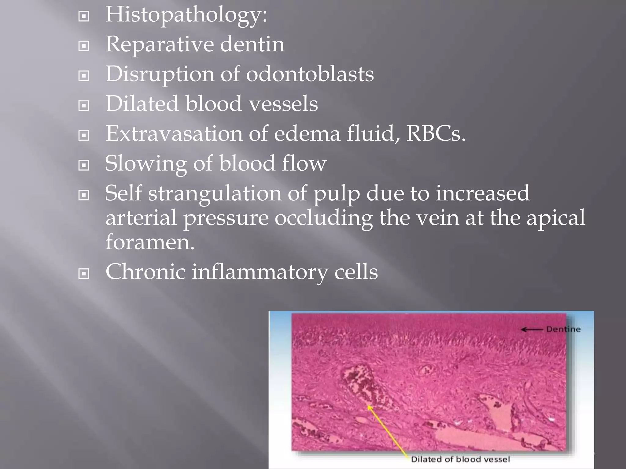 Diseases for pulp and periapical tissues | PPTX